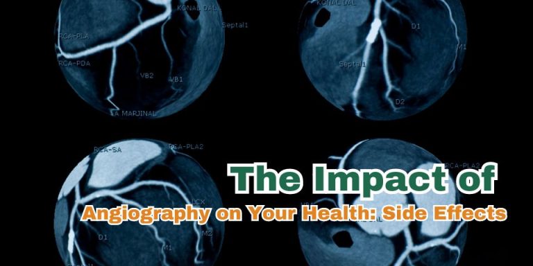 Side Effects of Impact of Angiography on Your Health | HiiMS