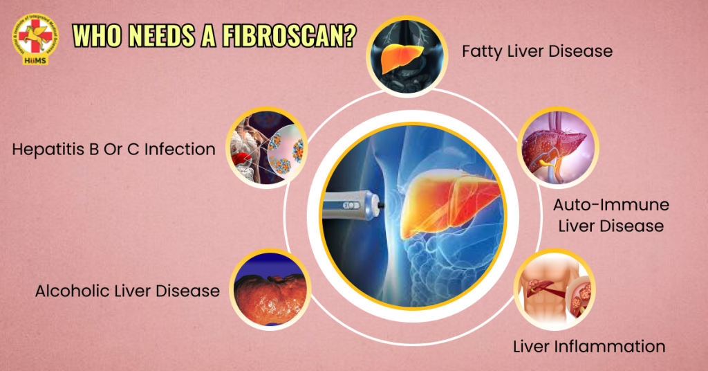 What is FibroScan? and How It Help to diagnose liver diseases?
