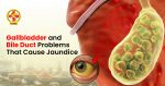 What Causes Jaundice? Liver, Blood & Bile Duct Reasons