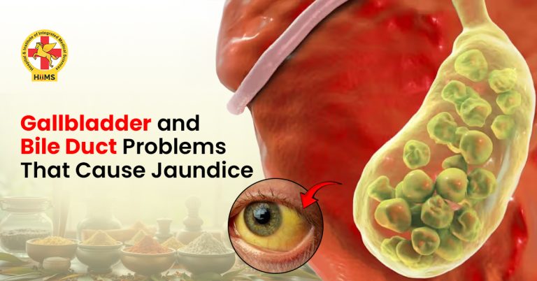 What Causes Jaundice? Liver, Blood & Bile Duct Reasons