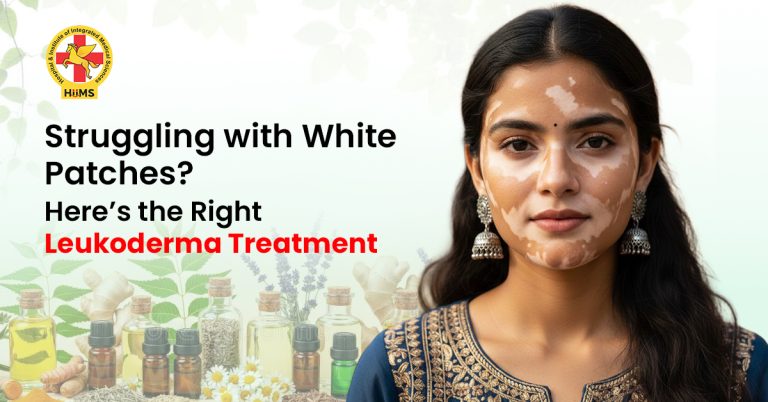 Leukoderma Treatment for Safe & Effective Skin Healing