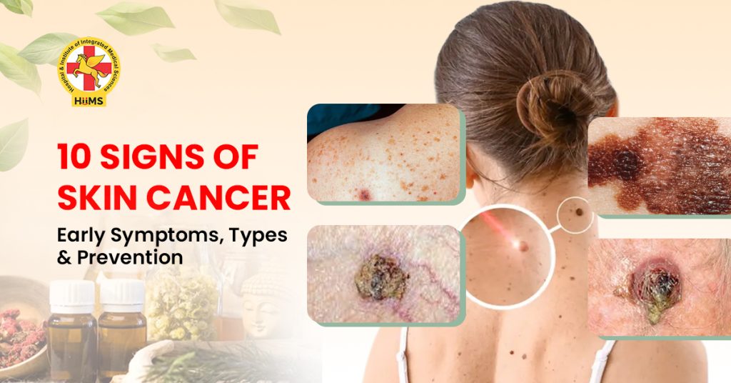 Early Signs of Cancer: Symptoms, Causes & Awareness
