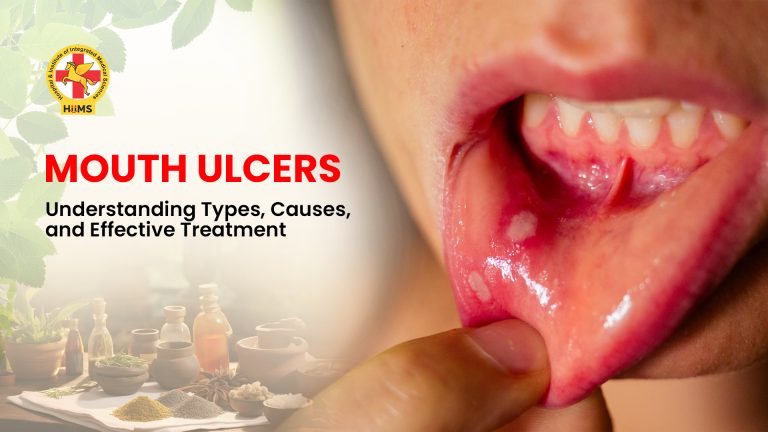 Mouth Ulcers: Types, Causes & Effective Treatment Guide