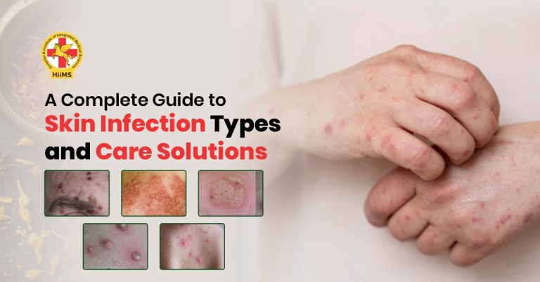 Complete Guide to Skin Infection Types and Care Solutions