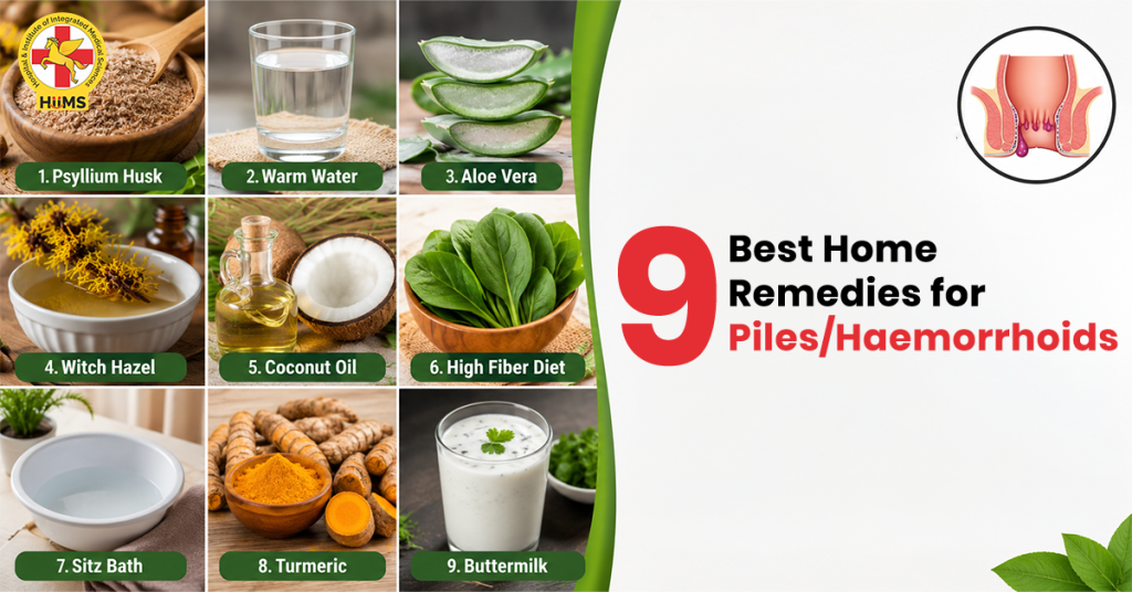 Home Remedies for Piles: 9 Natural Solutions Backed by Experts