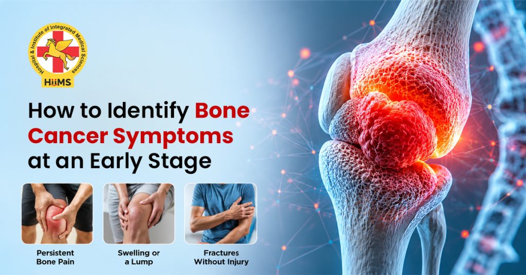 How to Identify Bone Cancer Symptoms at an Early Stage